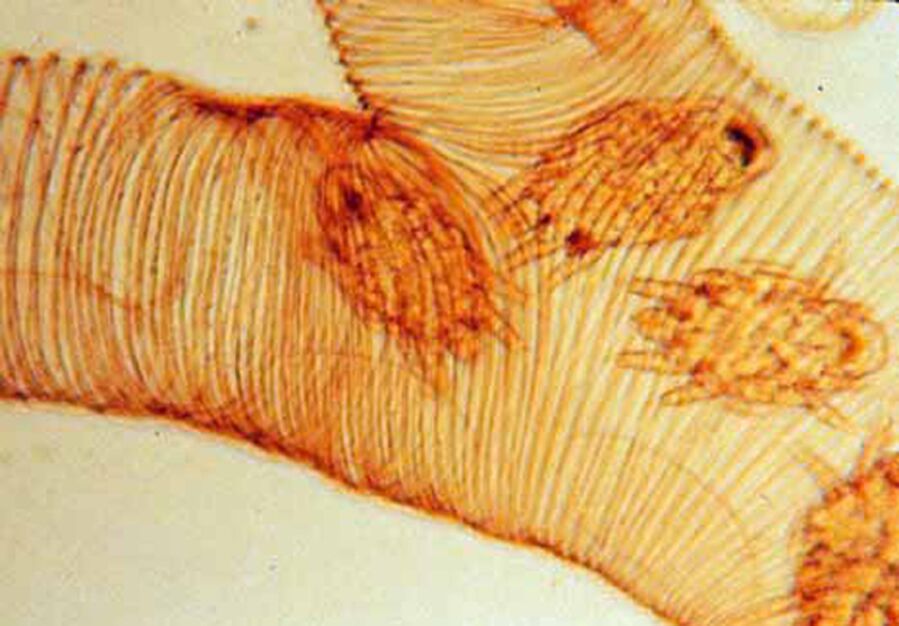 Do Bees Have Lungs? | How Do Bees Breathe?