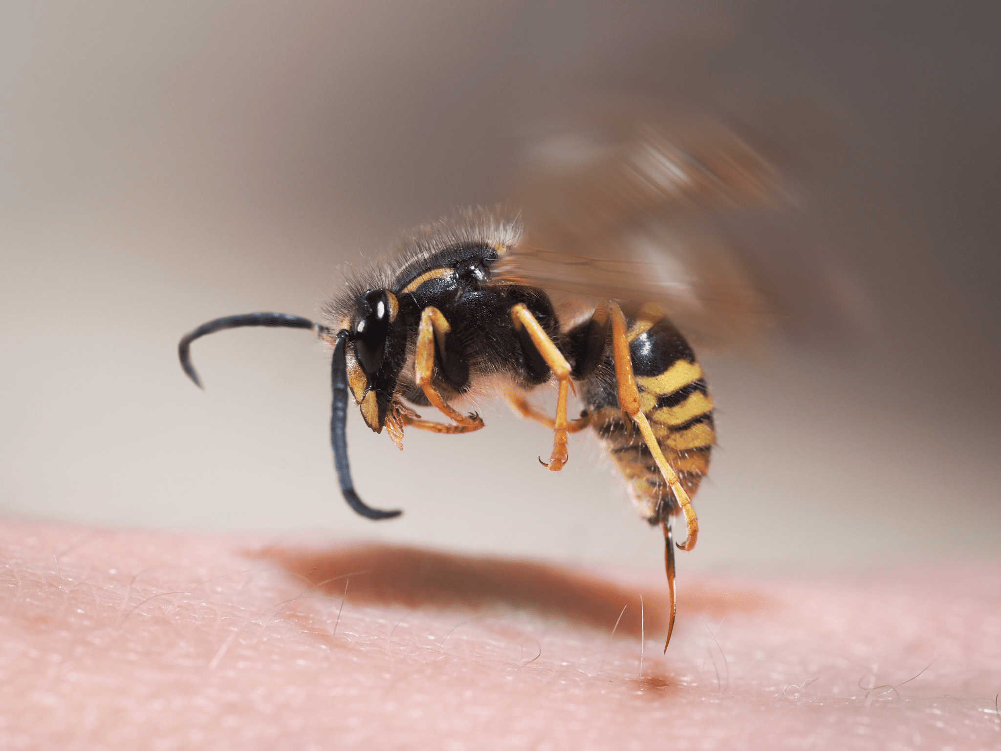 Wasp Sting | Here's What You Need To Know! | BeesWiki